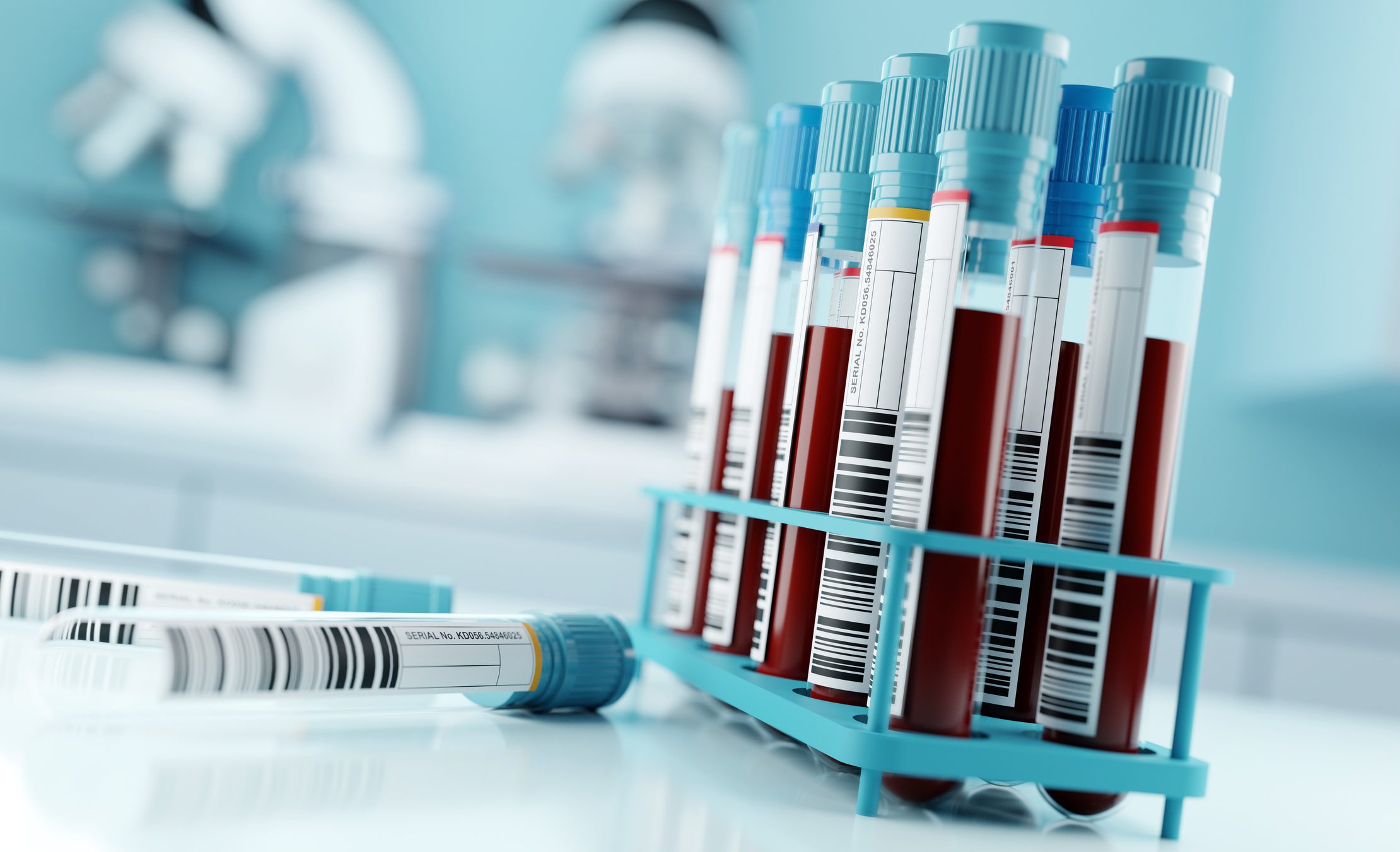 Blood Testing Labs - PFAS Exchange